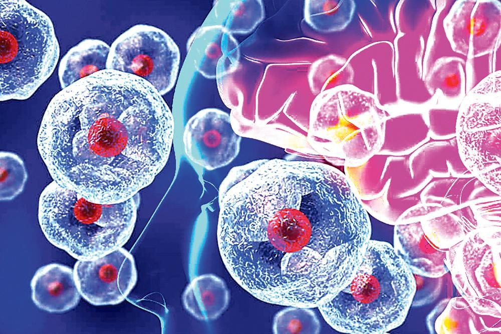 Transformación digital en la gestión de patologías crónicas - Occentus ...